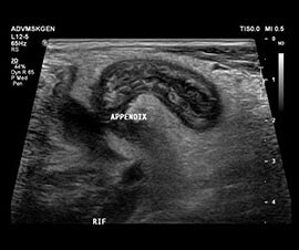 Philips Healthcare | Ultrasound Webinar Series