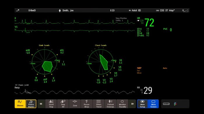 Clinical decision support tools | Philips Healthcare
